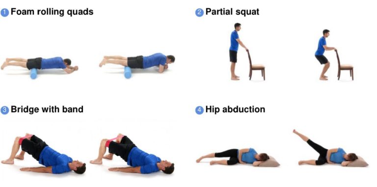 Patellofemoral pain (PFP) - The Physio Company